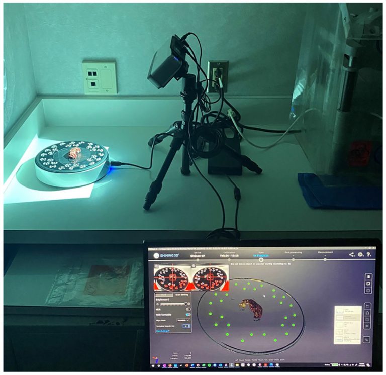 3D scanning is incorporated into the surgical pathology workflow