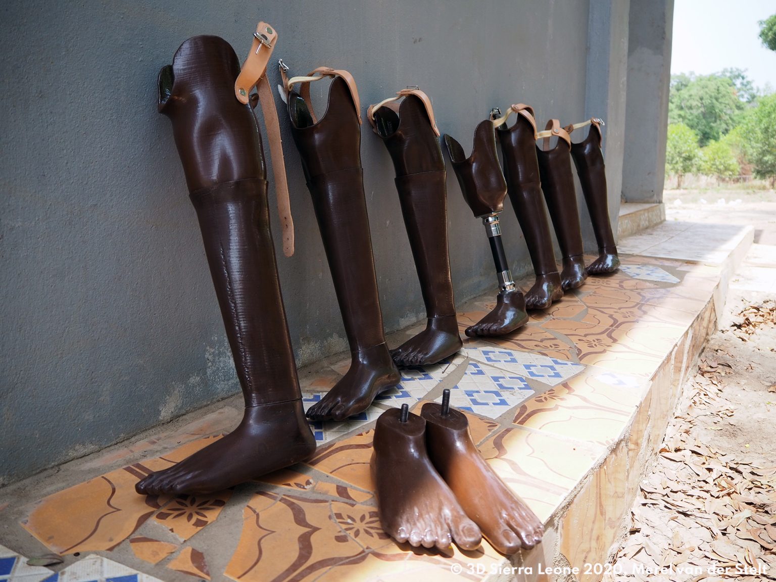 3D Printed Assistive Devices: Helping Amputees in Sierra Leone